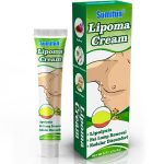 Lipoma Removal Cream - Remove Fatty Lump Tumor & Knot Under Skin ...